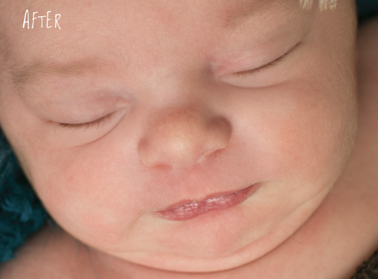 Milk Spots and Skin Flakes Newborn Photoshop Action - Dallas, Texas ...